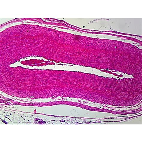 Prepared Microscope Slide Circulatory System Capillary Omentum