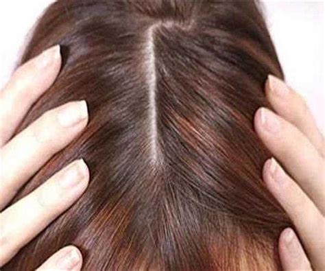 Get Rid Of Your Dandruff In The Best Way Mindstick