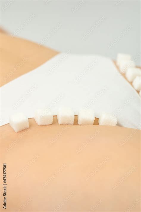 Sugar Cubes Lying In A Row On Female Bikini Zone The Concept Of Intimate Depilation Problems