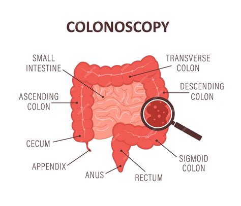 Premium Vector Colonoscopy Concept Intestine Exam And Treatment Bowel