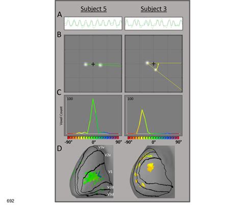 Dual Prf Symmetry Varies Across Subjects With Albinism A Fmri Responses Download Scientific