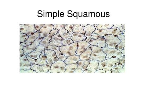 PPT Simple Squamous PowerPoint Presentation Free Download ID