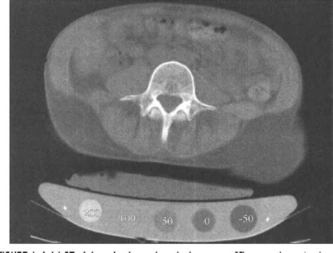 Figure From Role Of X Ray Imaging In The Development Of Drugs Semantic Scholar