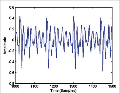 Understanding Spectrogram Of Speech Signal Using Matlab Program