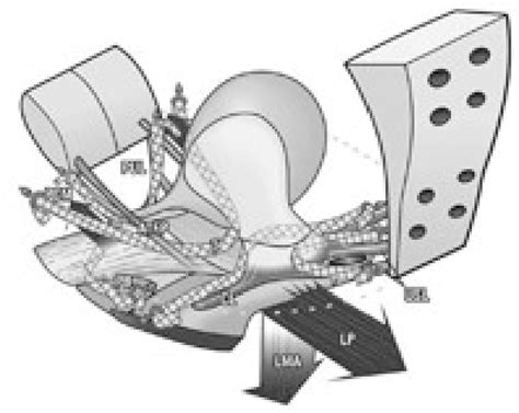 The Tfs Minisling Tissue Fixation System A New Approach To Surgery