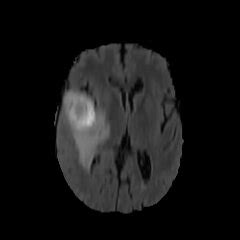 Four Imaging Modalities Used In The Brain Tumor Segmentation Task The Download Scientific