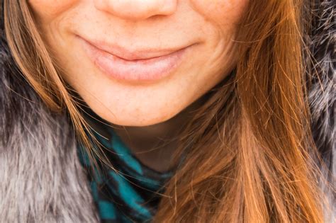 Cold Sores Causes And Treatments Broke And Chic