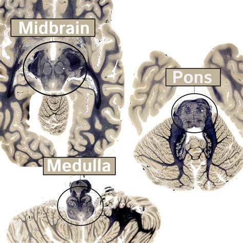 Neuroanatomy Glossary Medulla Oblongata Ditki Medical And Biological