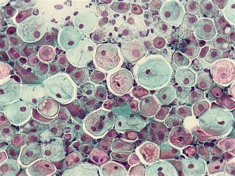 Citología Cervicovaginal Gamapath