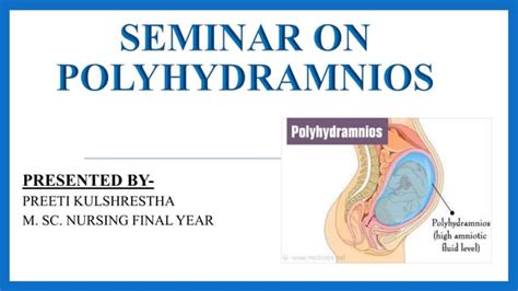 Polyhydramnios Pptx