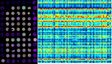 Spatial Transcriptomics For Understanding Tissue Architecture Euro Bioimaging