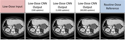Ct Noise Reduction Methods For Lower Dose Scanning Strengths And