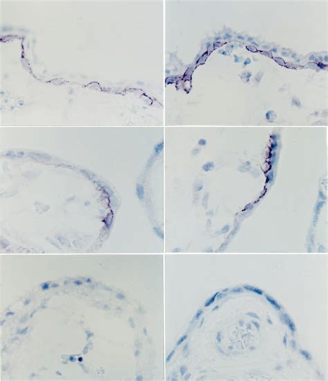 Immunolocalization Of E Cadherin E Cad Ac And β Catenin Bd In