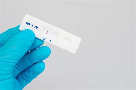 Hiv Testing Who Should Get Tested Doctor Có Sẵn