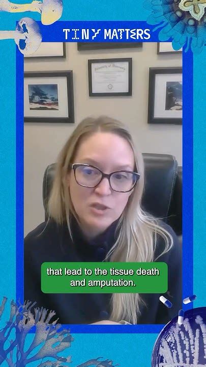 What Happens When You Get Frostbite Tiny Matters Clip