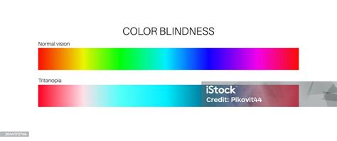 Tritanopia And Tritanomaly Stock Illustration Download Image Now Artists Palette Blindness