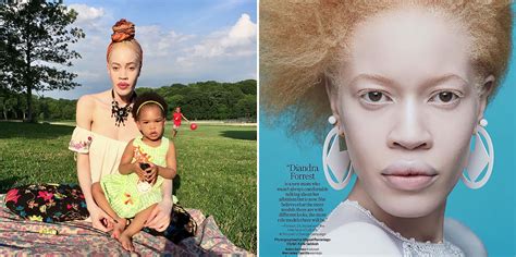 Meet Diandra Forrest Stunning Albino African American Model Design You Trust — Design Daily