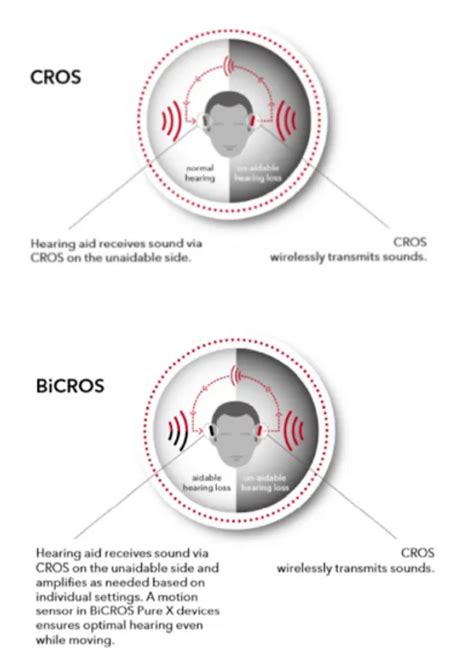What Are Cros And Bicros Hearing Aids