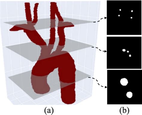 논문 리뷰 Pi Att Topology Attention For Segmentation Networks Through