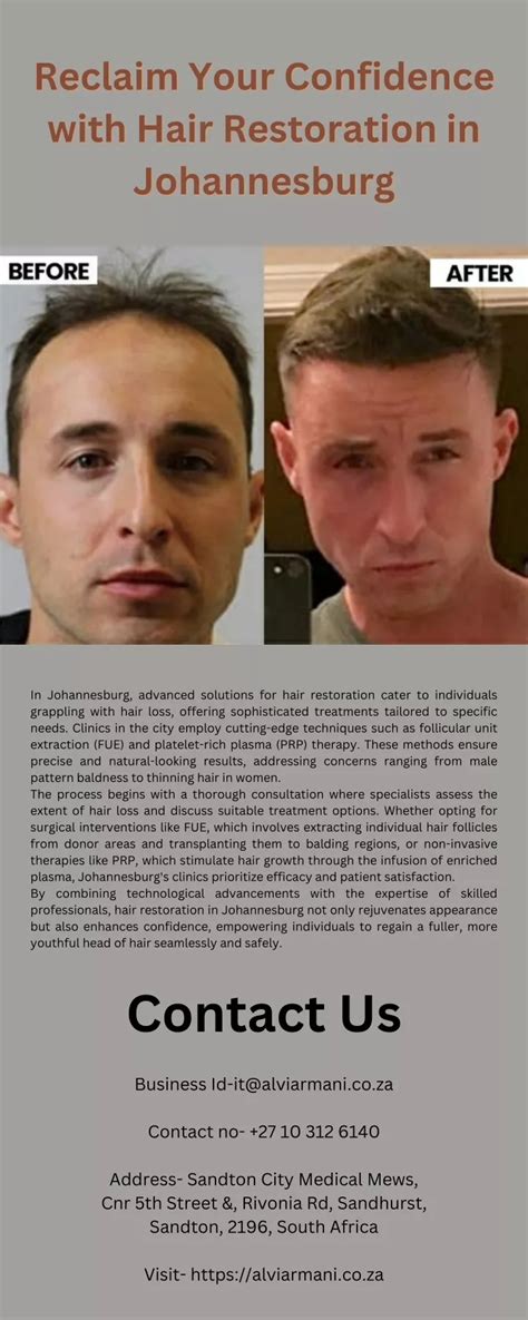 Ppt Reclaim Your Confidence With Hair Restoration In Johannesburg