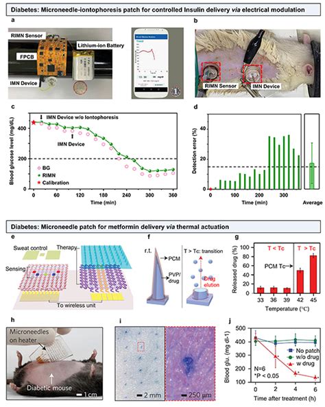 广东以色列理工学院王燕教授团队 ACS Nano 综述柔性治疗生物电子 中国聚合物网科教新闻