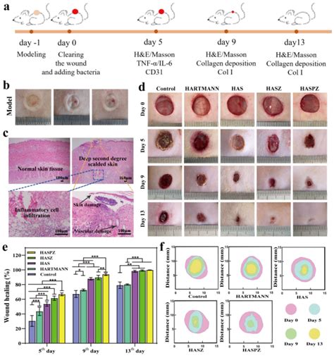 Nano Res 生物 │西北大学范代娣课题组：一种具有多重ph响应性的抗菌水凝胶用于促进感染烧烫伤修复 X Mol资讯
