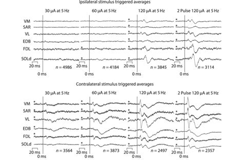 Stimulus Triggered Averages Of Emg Activity Using Various Stimulus