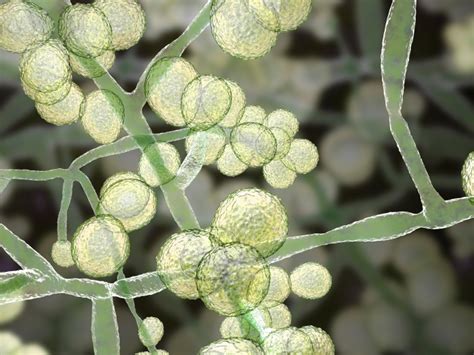 Simple Neural Networks Outperform The State Of The Art For Controlling Robotic Prosthetics