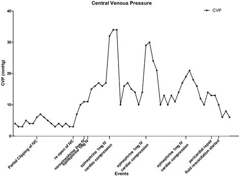 Graph Of CVP An Abrupt Increase In CVP Occurred During Cardiac Download Scientific Diagram