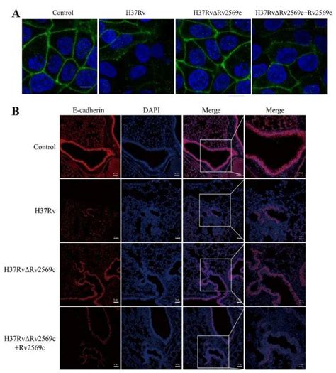 科研进展 哈兽研刘思国研究员 党光辉副研究员：揭示结核分枝杆菌突破宿主上皮屏障促进其扩散的新机制 肺脏 相关研究