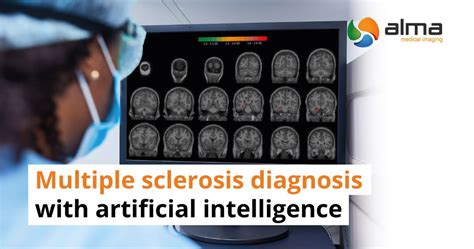 Diagnosing Multiple Sclerosis With Artificial Intelligence