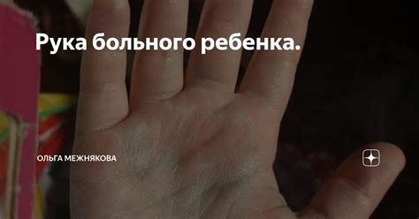 Рука больного ребенка Ольга Межнякова Дзен