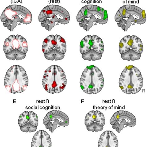 Meta Analytic Comparison Of The Dmn As Defined By Resting State