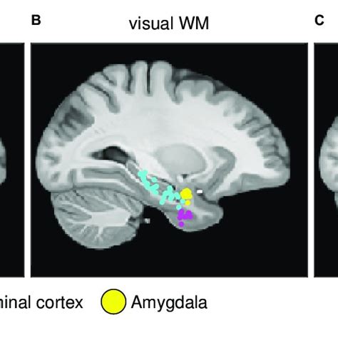 Electrode Localization Anatomical Locations Of The Tips Of The Depth Download Scientific