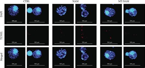 Dna Fragmentation Analysis After Nam Treatment In The Presence And Download Scientific Diagram