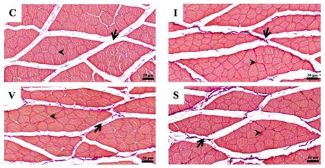 The Photomicrographs Of Picrosirius Red Staining Of Quadriceps Muscle Download Scientific