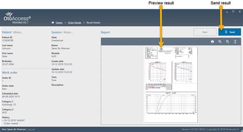 How To Use OtoAccess Worklist HL7 Interacoustics