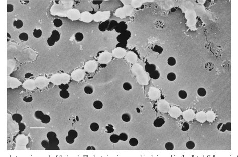 Streptococcus Constellatus Semantic Scholar