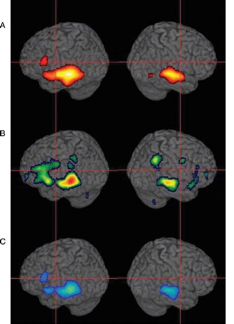 Figure 1 From A Functional Anatomical Model For Lipreading Semantic Scholar