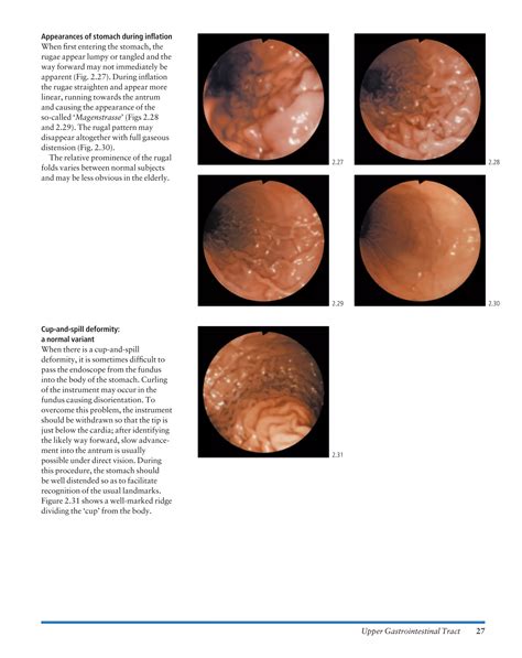 Atlas Of Gastrointestinal Endoscopy And Related Pathology Blackwell