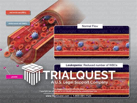 Leukopenia Trialquest Inc