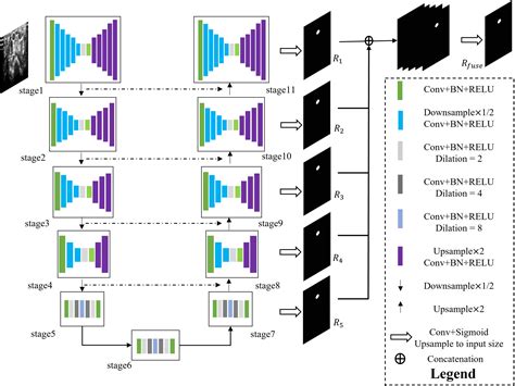 Application Of An Improved U2 Net Model In Ultrasound Median Neural