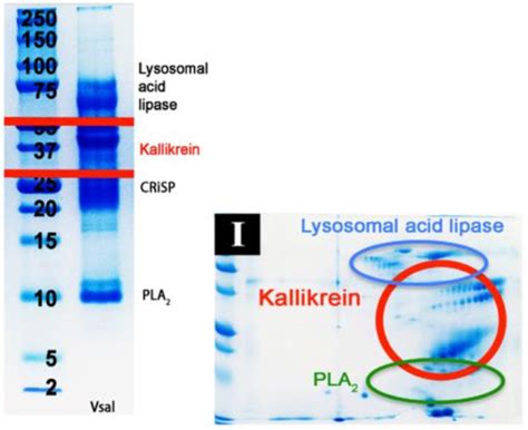 Proteomic Analyses Show The Diversity Of Components Present In The Download Scientific Diagram