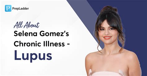 All About Selena Gomezs Chronic Illness Lupus Prepladder