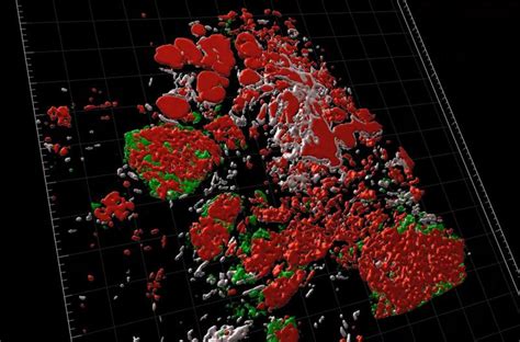 3d Tumor Maps Give Researchers An Unprecedented Look At Cancer Growth Mark Muller