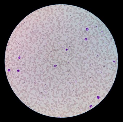 Microscopic View Of Hematology Stained Slide In Laboratory Stock Image