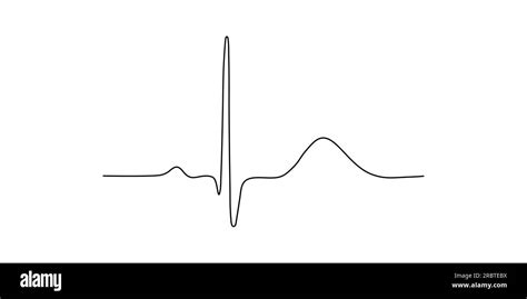 Ventricular Repolarization T Wave The QT Interval Of ECG The Cardiac Cycle ECG Of A Heart In