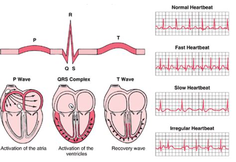 Different Heart Rhythms Hubpages