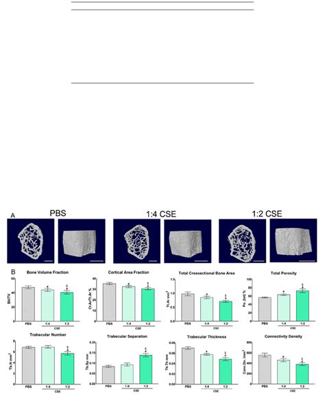 Dose Dependent Effects Of Cse Exposure On Bone Morphometry Femurs Download Scientific Diagram