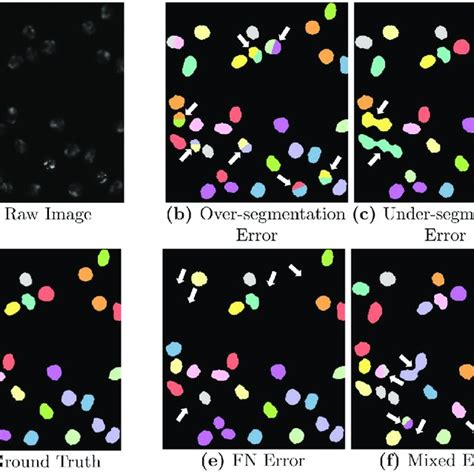 Simulated Segmentation Errors Shown Is A Raw Image Of The